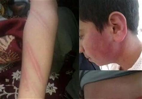 آمارها از تنبیه بدنی در مدارس چه می گویند؟