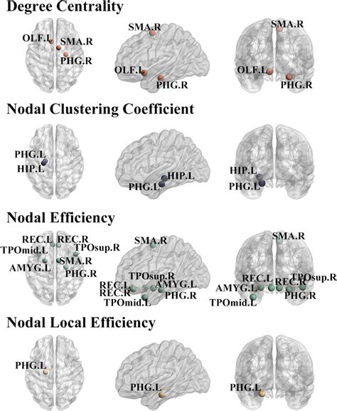 Figure 2 From Graph Theory Further Revealed Visual Spatial Working