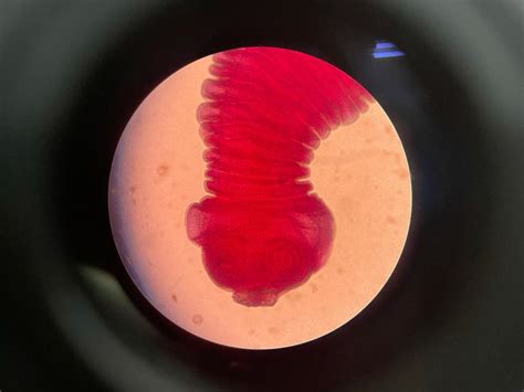 Taenia Solium Scolex In 2024 Laboratory Specimens Electron Microscope Images Microscope
