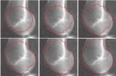 Example Of Active Contour Segmentation As The Curve Evolves In Time C