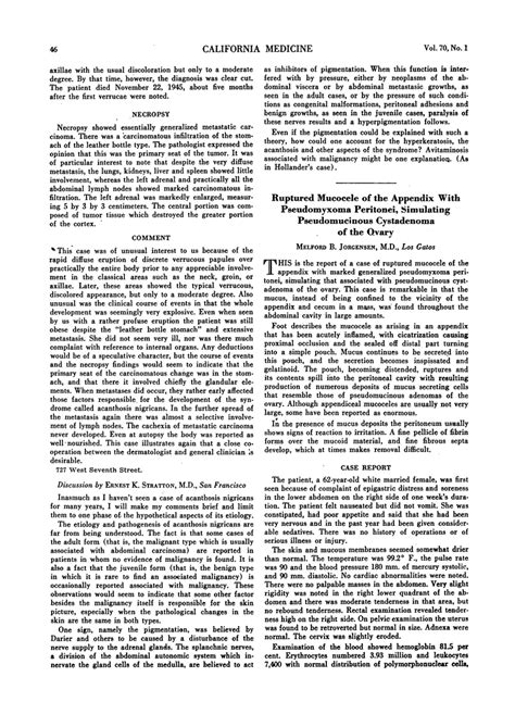 Ruptured Mucocele Of The Appendix With Pseudomyxoma Peritonei Simulating Pseudomucinous