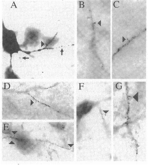 Allocortex Semantic Scholar