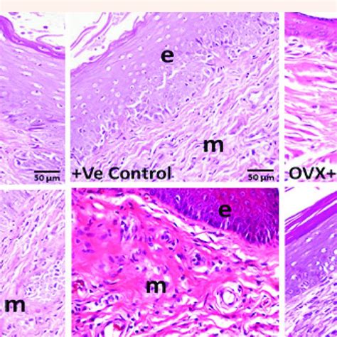 Pdf Restoration Of Vaginal Epithelial Atrophy In Ovariectomized Rats
