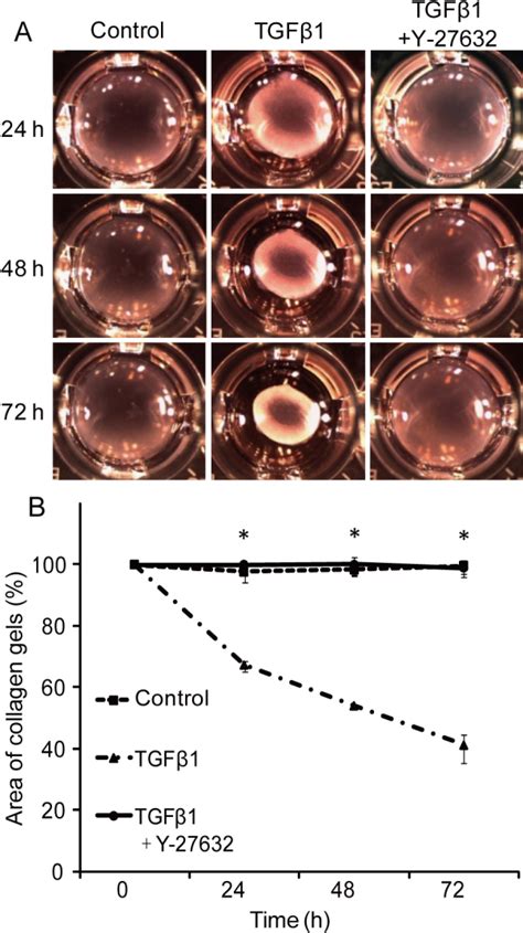 The Effect Of Y 27632 On Fibroblast Contractility A Tgfβ1 Induced