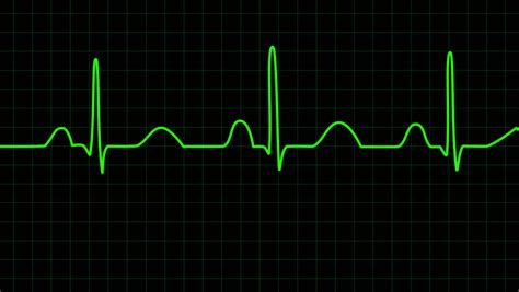 Animated Ekg Display Stock Footage Video 7733179 Shutterstock