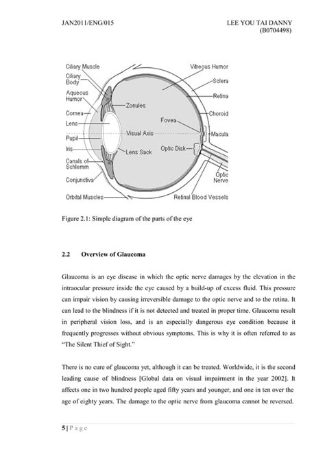 automated glaucoma detection pdf
