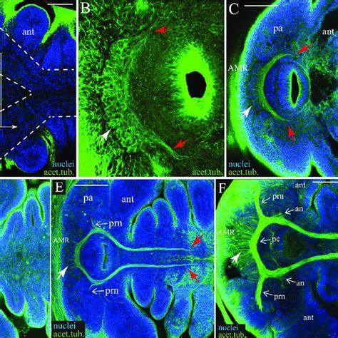 Axons Originating From An Anterior Medial Cell Population Erect The Download Scientific Diagram