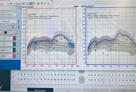 Bridgitte Harley On Linkedin Bernafon 21 Comments