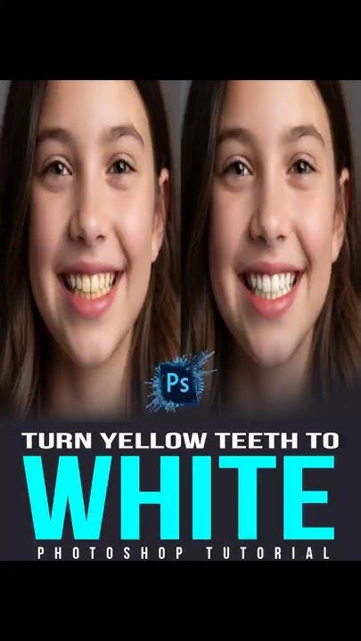 Turn Yellow Teeth To White In Photoshop Shorts Youtube