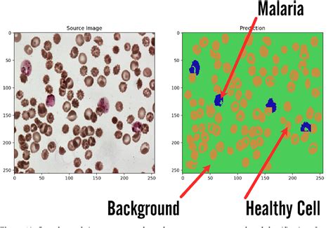 Figure 10 From Malaria Detection Using Advanced Deep Learning