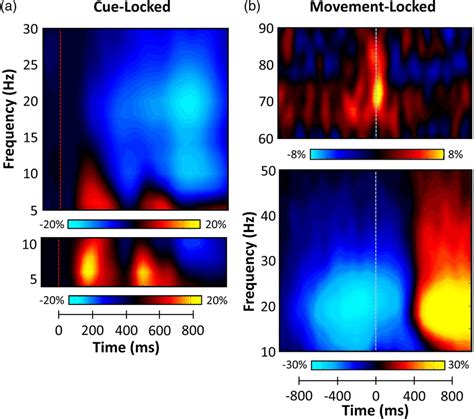 Magnetoencephalography Meg Sensor‐level Spectrograms A Cue‐locked