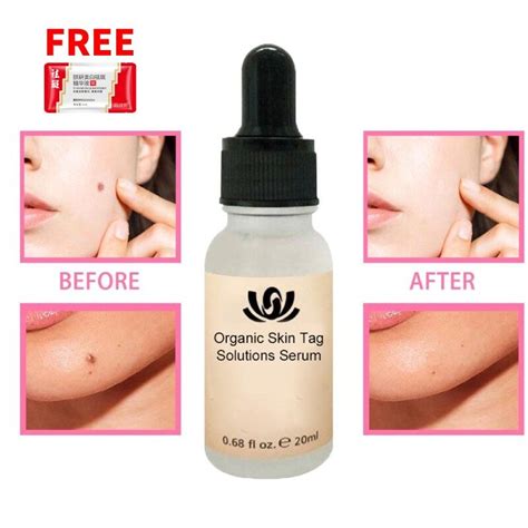 Organic Tags Solutions Serum 20ML Skin Tag Remover Serum Organic Skin