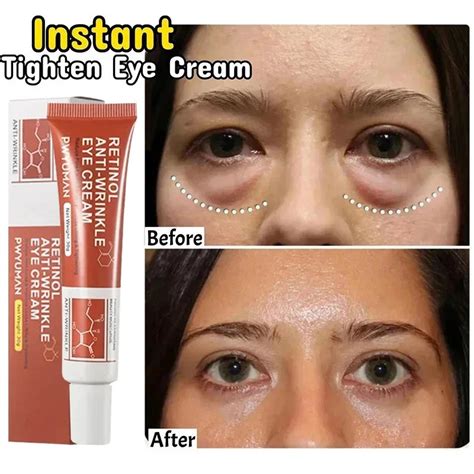 Fast Eye Bag Remove Eye Cream Anti Fat Particles Repair Skin Barrier