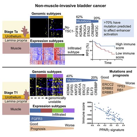 Stage Stratified Molecular Profiling Of Non Muscle Invasive Bladder