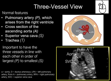 Fetal Cardiac Screening Sonography Radiology World