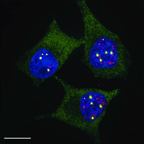 Hela Cells Stably Expressing Gfp Smn Showing Localization Of Gfp Smn
