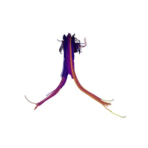 Enhancing Quickbundles With Different Metrics And Features — Dipy 1110 Documentation