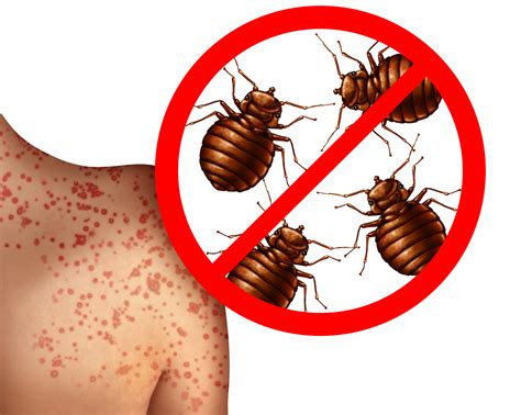 Early Signs Of Bed Bug Infestation Heat Rx