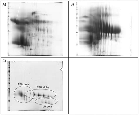 2d Gel Electrophoresis Separation Of Urinary Hmg And Recombinant Download Scientific Diagram