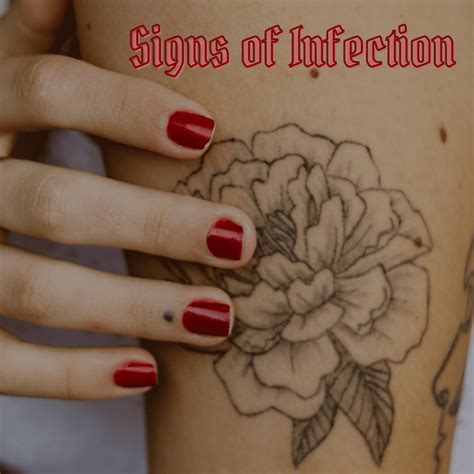 Update More Than 69 Bruise Around New Tattoo Latest Incdgdbentre