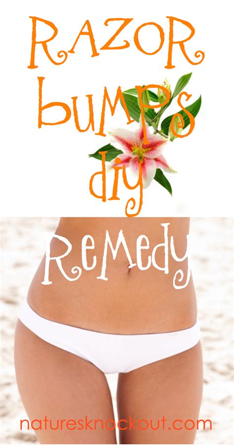 Razor Bumps Natural Remedy Health And Beauty Tips Beauty Remedies
