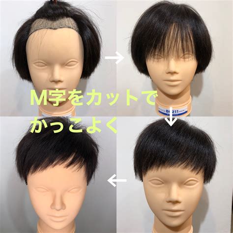 M字の薄毛をおしゃれに変えるカットの実例 薄毛に悩む男性の為の美容室ならRELIVE 薄毛に悩む男性のための完全個室美容室