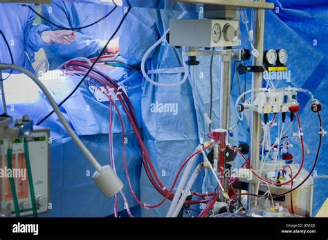 A Cardiopulmonary Bypass Or Heart Lung Machine Has Taken Over The