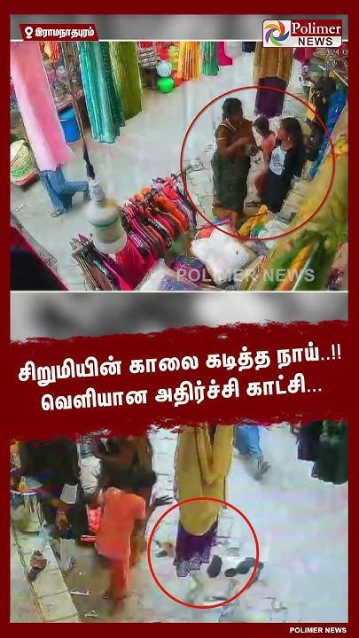 சிறுமியின் காலை கடித்த நாய் வெளியான அதிர்ச்சி காட்சி Shorts