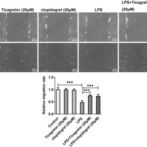 Ticagrelor or clopidogrel treatment modulates NFκB IκBα signaling