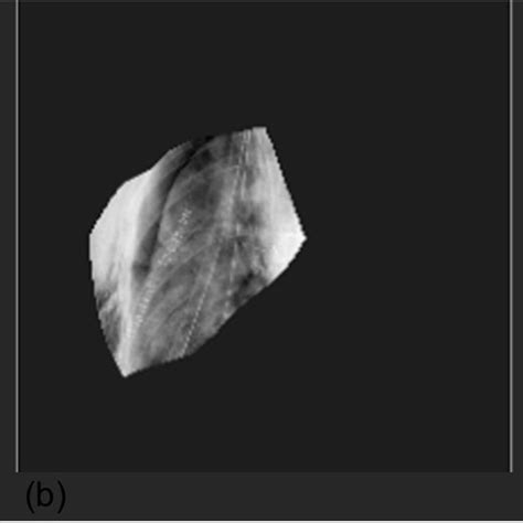 Visualization Of Device Prediction Maps For Two Selected Cxrs The Download Scientific Diagram