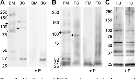 Figure 2 From Identification Of The Wnk Spakosr1 Signaling Pathway In