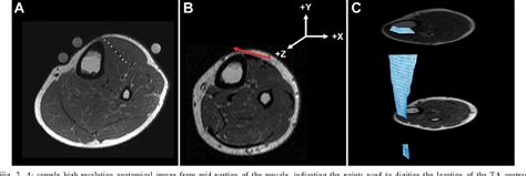 Figure 2 From Quantitative Diffusion Tensor Mri Based Fiber Tracking Of Human Skeletal Muscle