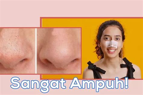 Cara Menghilangkan Komedo Di Hidung Dengan Cepat Dan Benar Suara Karya