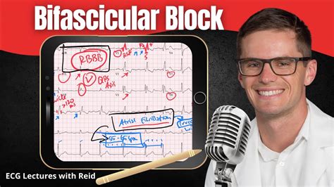 Bifascicular Blocks Ekg Ecg Lecture Youtube