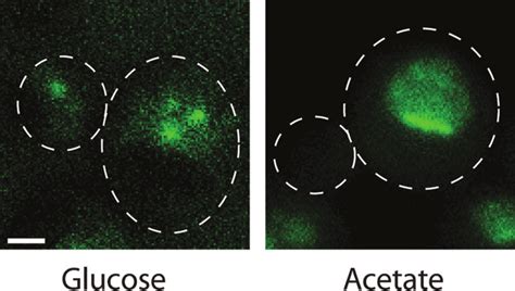 Yeast Vps13p Localization Yeast Vps13 Localization Is Dependent On The