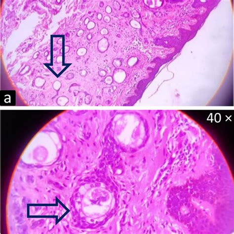 A Histopathological Specimen Stained With Hematoxylin And Eosin 20