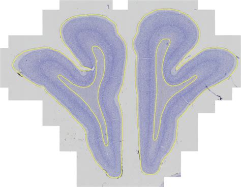 Problem About The Software Qupath Usage And Issues Imagesc Forum