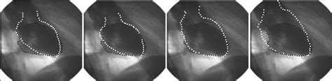 6 An Example Of Spurious Error Criterion Behavior Black Dotted Lines