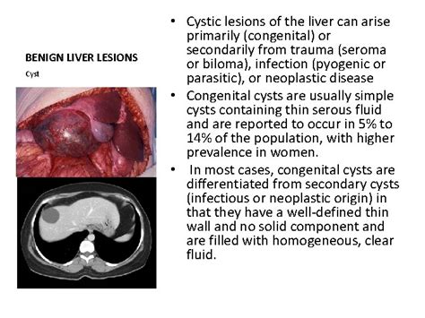 Liver Anatomy And Physiology The Liver Is Divided