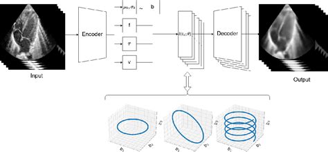 Figure 1 From Anomaly Detection In Echocardiograms With Dynamic
