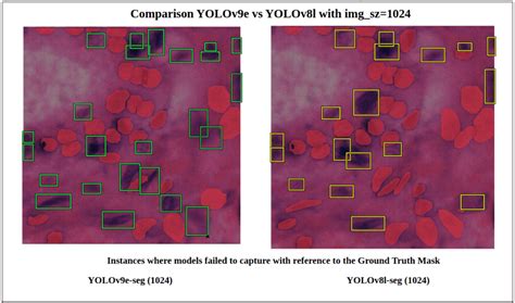 YOLOv Instance Segmentation On Medical Dataset