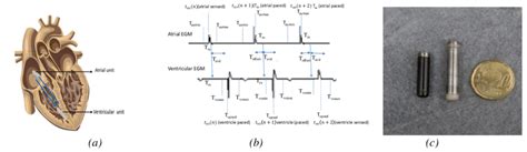 A Dual Chamber Leadless Pacemaker System Configuration With Units Download Scientific Diagram