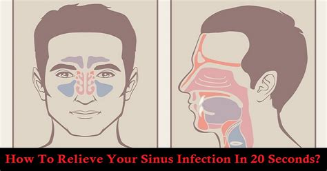 Kill Sinus Infection In 20 Seconds With This Simple Method