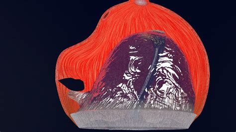 Retinal Detachment Types Eye 3d Model Superhive Formerly Blender Market