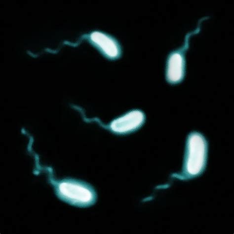 Iron Overload Disease Causes Rapid Growth Of Deadly Vibrio Vulnificus