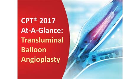 Ppt Cpt® 2017 At A Glance Transluminal Balloon Angioplasty