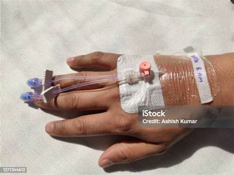 혈액 주입 및 샘플 수집을 위한 인간의 손의 정맥에 있는 캐니션 또는 정맥 카테터 건강관리와 의술에 대한 스톡 사진 및 기타