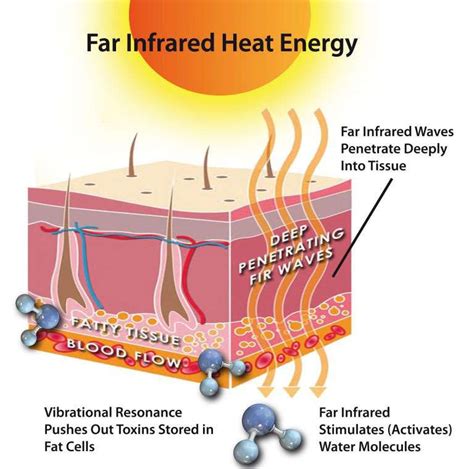 Far Infrared Treatment Fiona Corliss