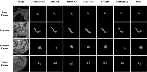 Transforming The Interactive Segmentation For Medical Imaging