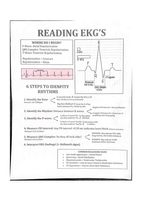 EKG Readings Studocu
